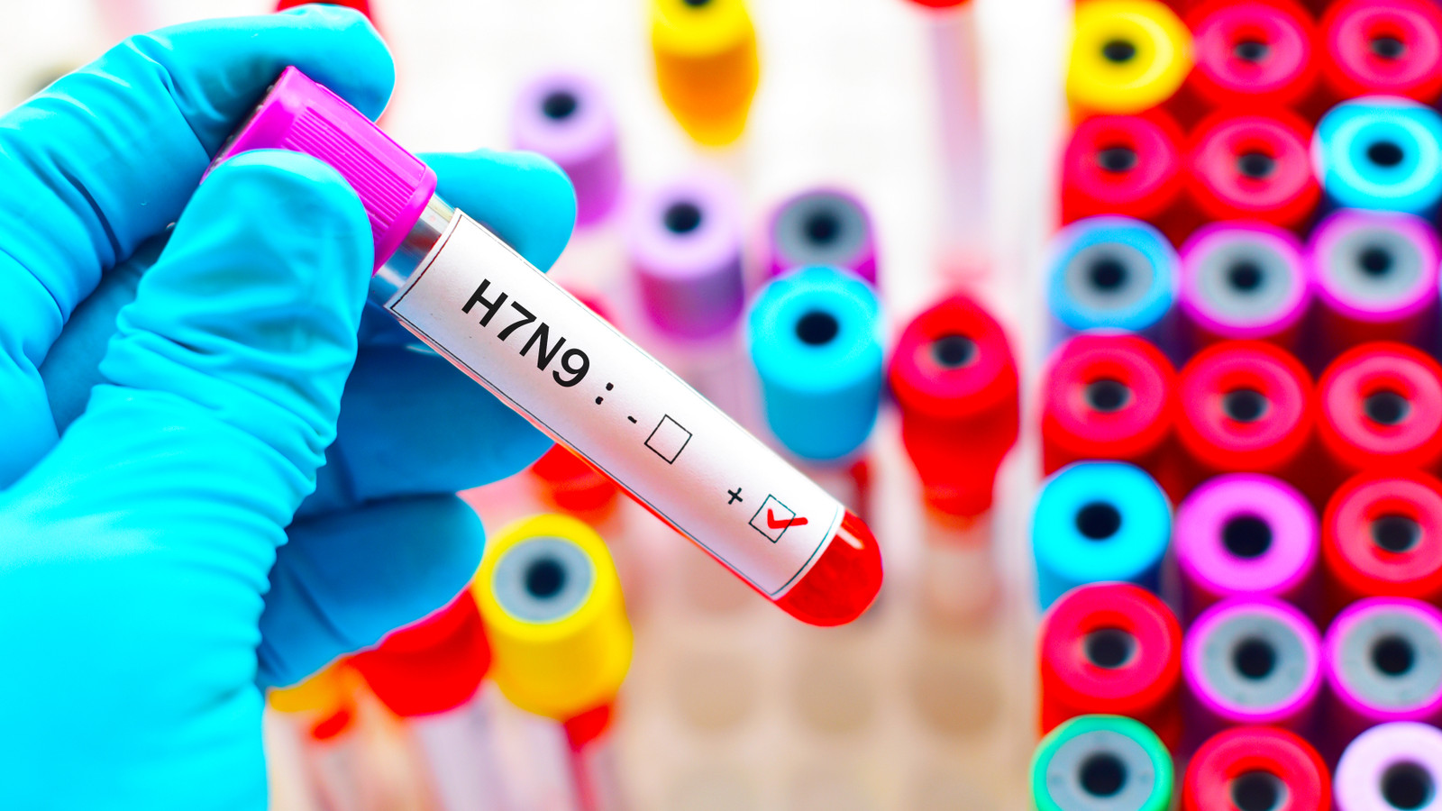 My title: Returning Bird Flu Strain Is Back In The States For The First ...